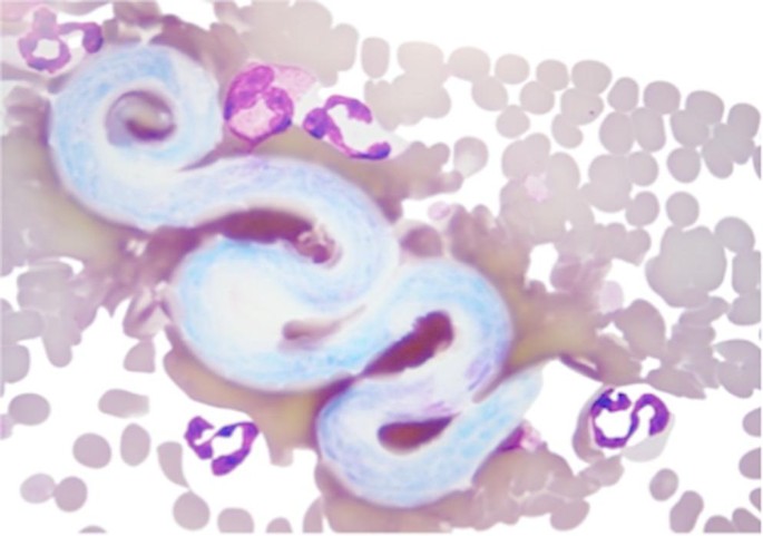 Unveiling Dirofilaria Asiatica infection: first clinical insights and ...