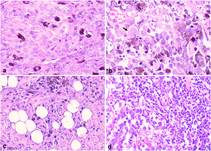 Canine cutaneous melanocytic tumors: main histopathological parameters ...