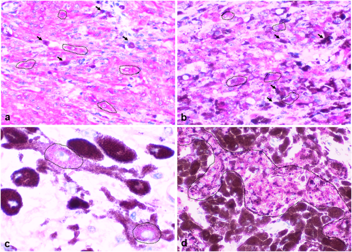 Canine cutaneous melanocytic tumors: main histopathological parameters ...