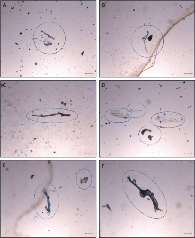 Qualitative and Quantitative Analysis of Microplastics in the Surface ...