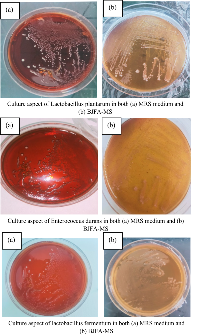 Formulations of novel microbial medium from beetroot powder: a ...