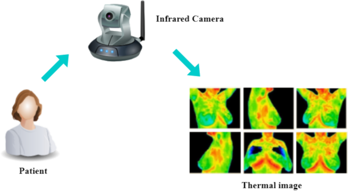 An Extensive Review on Emerging Advancements in Thermography and ...