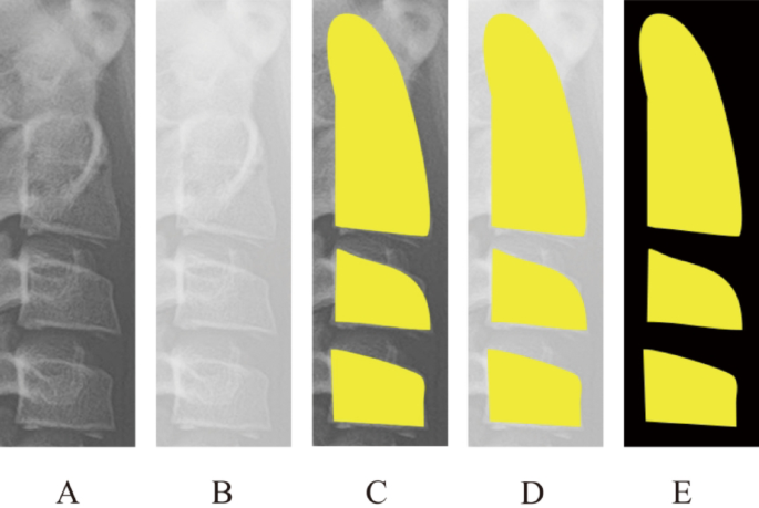 Impact of image processing techniques on deep learning-based ...