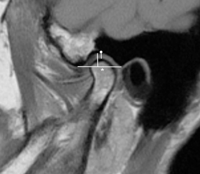 Bidirectional analysis of clinical and MRI correlations in ...