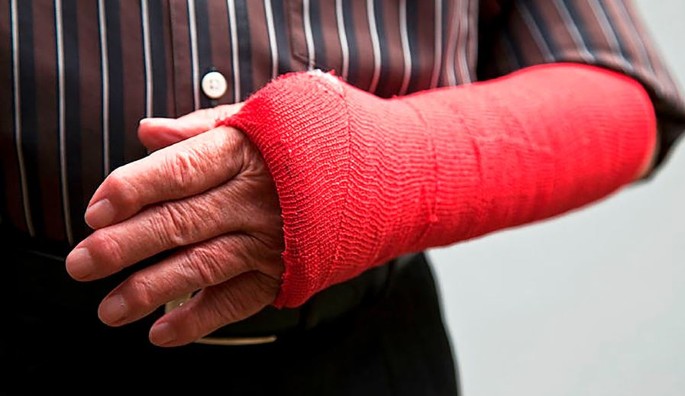 Gips bei Radiusfraktur: Schiene oder zirkulär? | CME