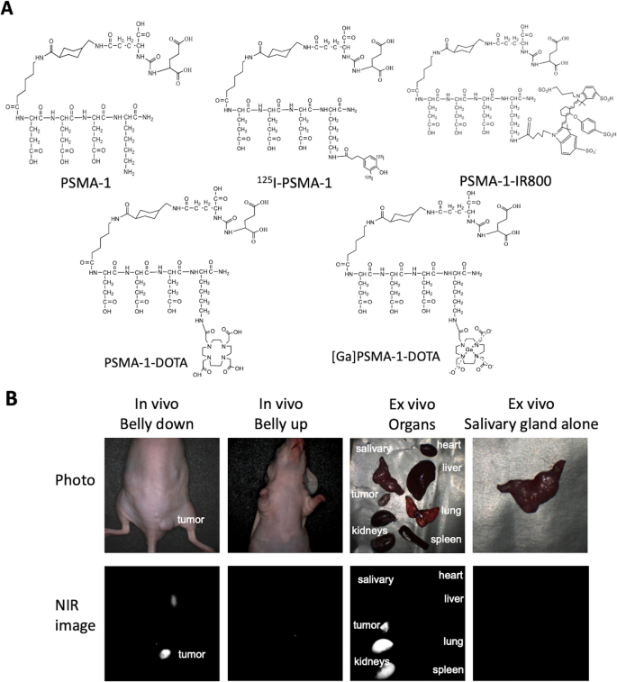 PSMA-1-DOTA Potentially for Effective Targeted Radioligand Therapy of ...