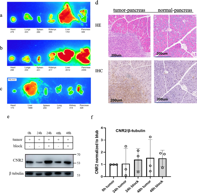 Molecular Imaging of Pancreatic Duct Adenocarcinoma Using [18F]JR-1004 ...