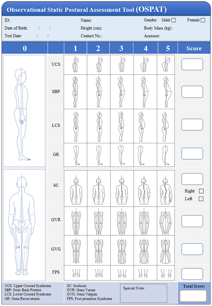 Development and validation of the observational static posture assessment tool (OSPAT): a ...