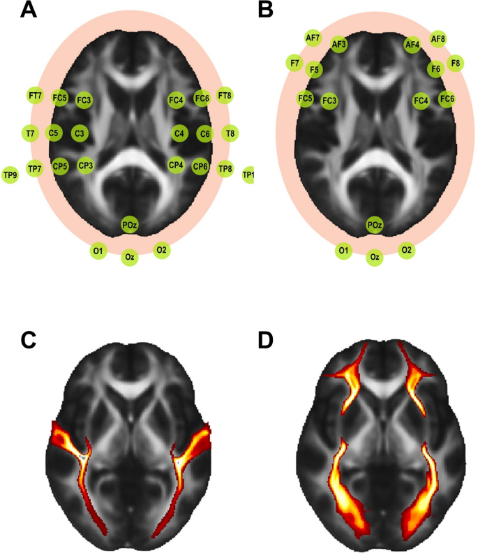 White matter microstructural integrity as a key to effective ...