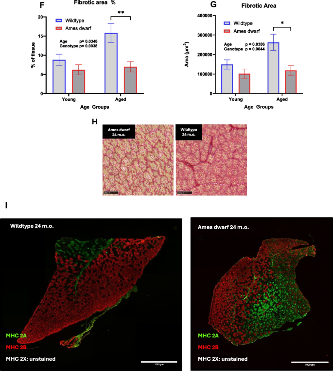Growth hormone–deficient Ames dwarf mice resist sarcopenia and exhibit ...