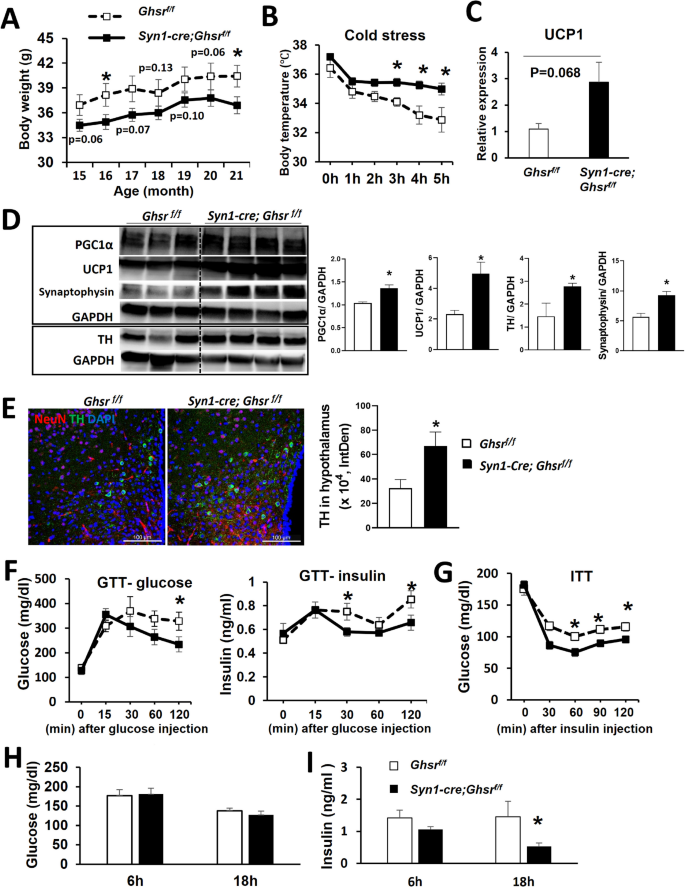 GHSR suppression in neurons protects against aging-associated metabolic ...