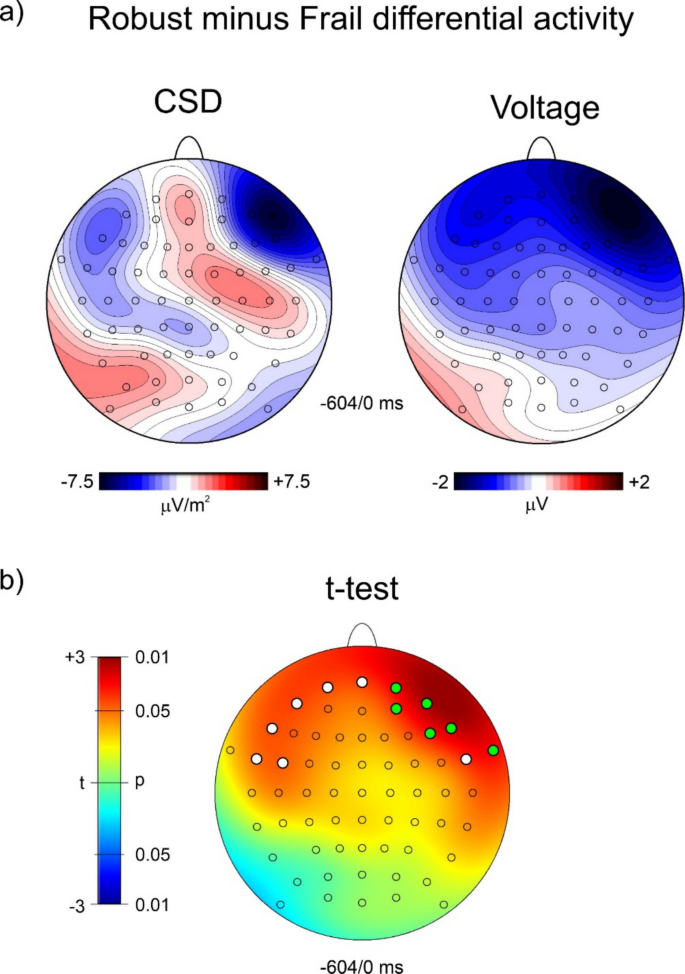 Impairment in anticipatory cognitive brain processing in frail older ...