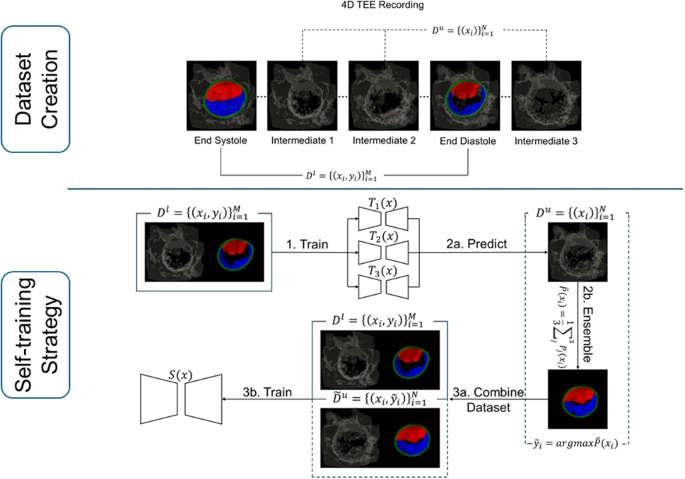 Automatic 4D mitral valve segmentation from transesophageal echocardiography: a semi-supervised ...
