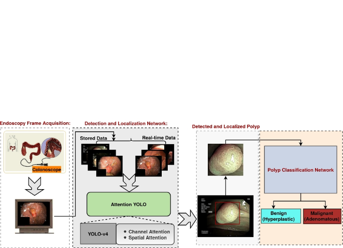 Attention-guided deep framework for polyp localization and subsequent classification via polyp ...