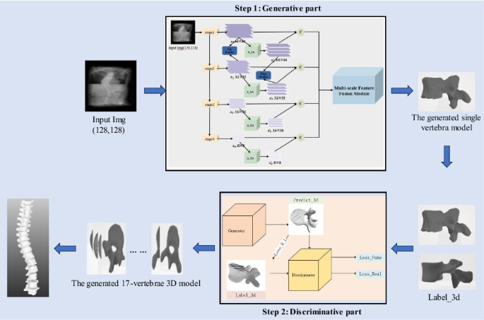 3D spine reconstruction from a single radiograph based on GANs ...