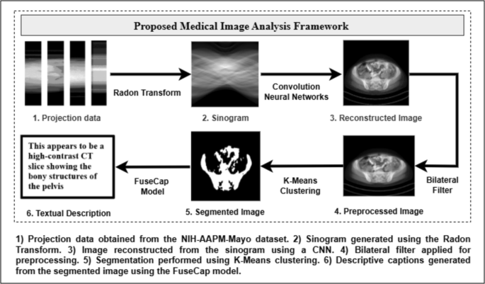Integrating CT image reconstruction, segmentation, and large language ...