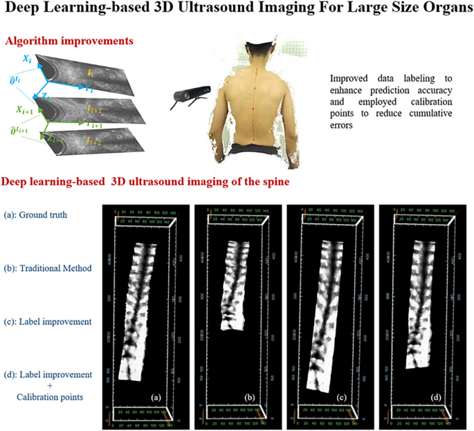 Deep learning-based high precision 3D ultrasound imaging for large size ...
