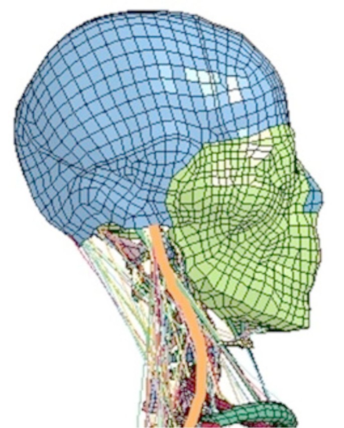Biomechanical simulation of the head–neck complex with active muscle ...
