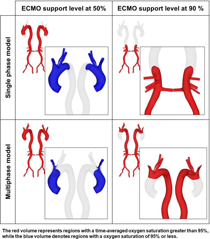 Computational analysis of haemodynamics and oxygen distribution in the patient-specific aorta ...