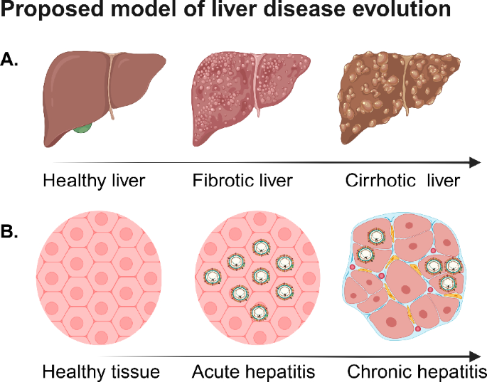 Investigation of a Two-Patch Within-Host Model of Hepatitis B Viral ...