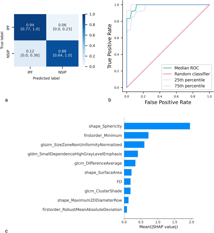 Unlocking the potential of radiomics in identifying fibrosing and ...