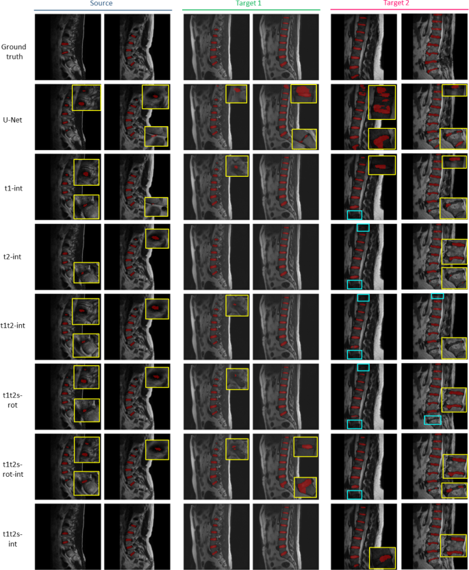 An intensity-based self-supervised domain adaptation method for ...