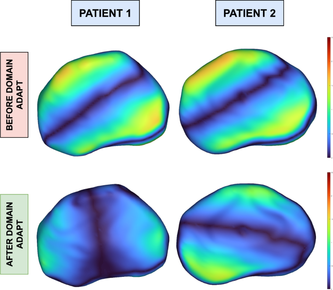 Domain adaptation using AdaBN and AdaIN for high-resolution IVD mesh ...
