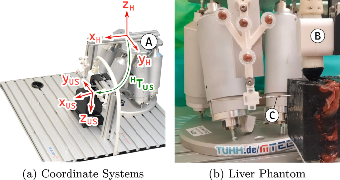 Needle tracking in low-resolution ultrasound volumes using deep ...