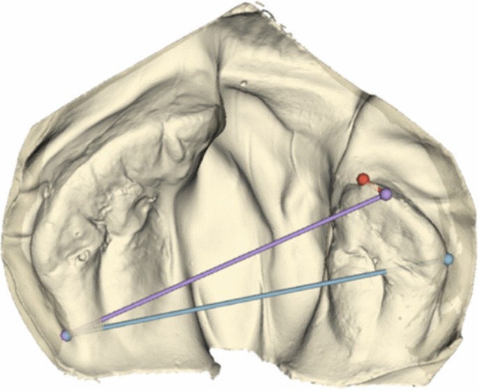 AI-enhanced predictive modeling for treatment duration and personalized ...
