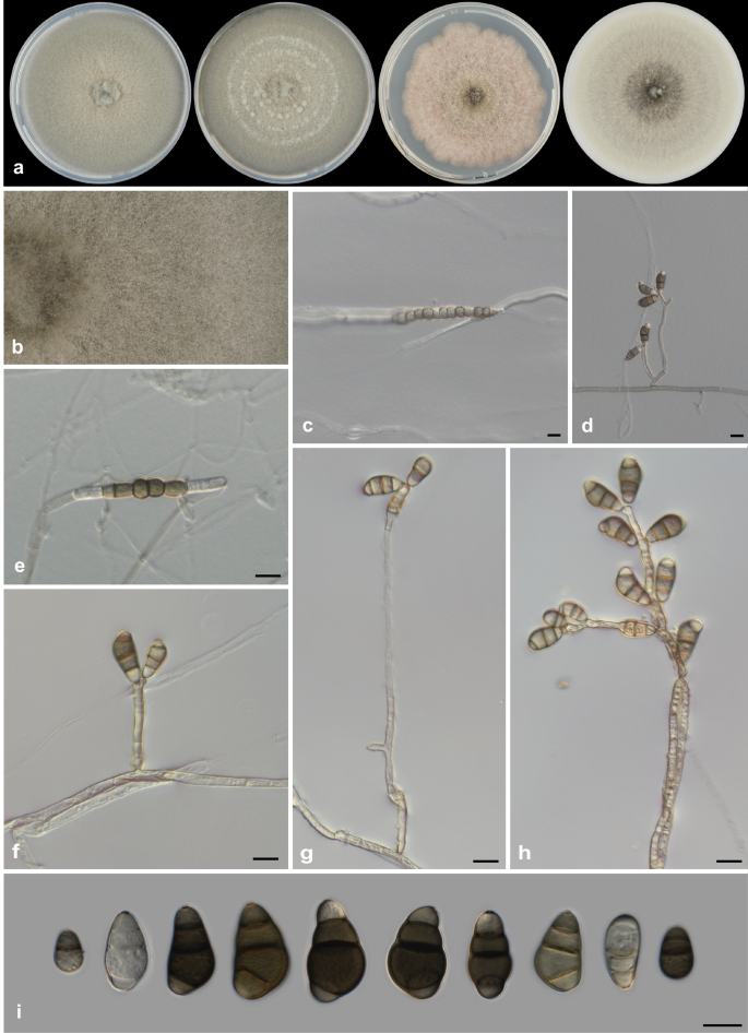 Five novel Curvularia species (Pleosporaceae, Pleosporales) isolated ...