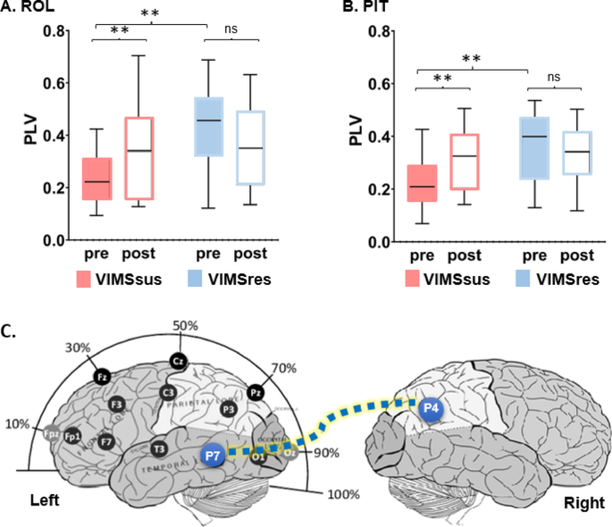 Dynamic brain connectivity: linking inter-group difference and ...