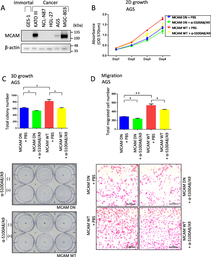 S100A8/A9-MCAM signaling promotes gastric cancer cell progression via ...