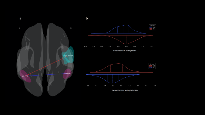 Atypical segregation of frontoparietal and sensorimotor networks is ...