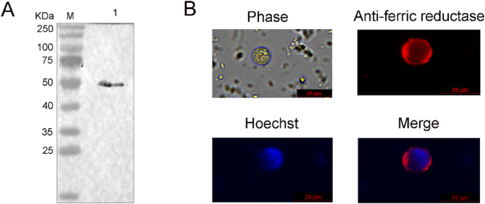 Ferric Reductase is a Key Factor in Regulating Iron Absorption by ...