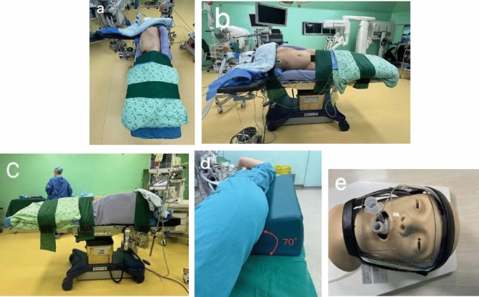 Improved positioning in robotic assisted laparoscopic partial ...