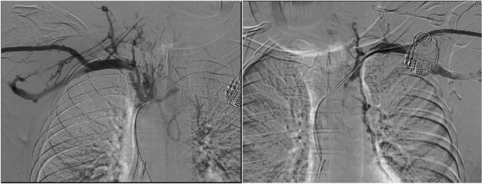 Threaded enigma: unraveling the diagnostic maze | Internal and ...