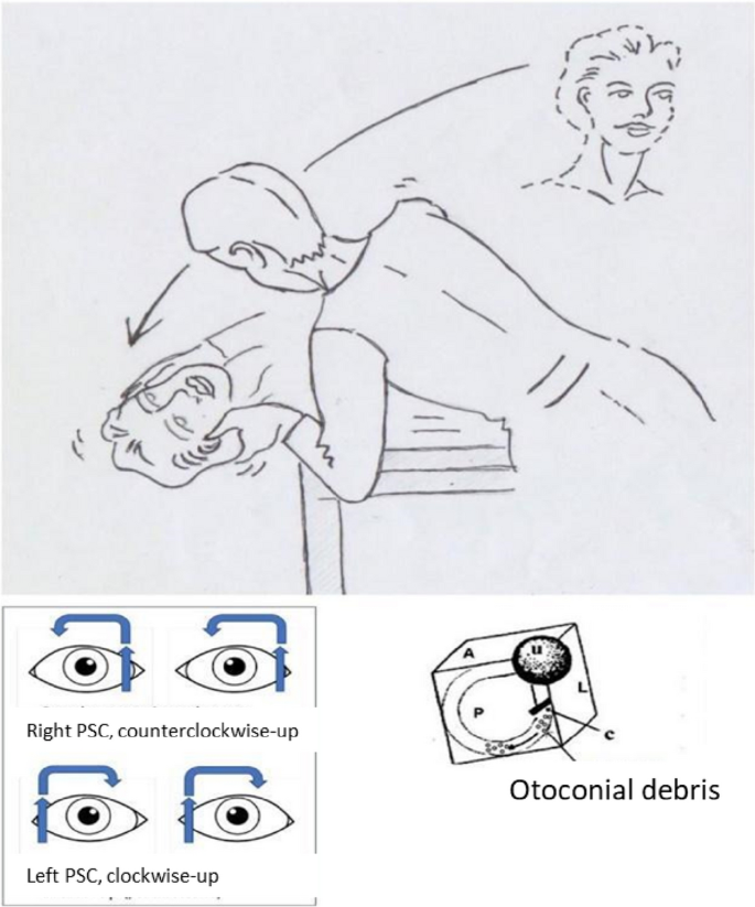 Consensus paper on the management of acute isolated vertigo in the ...