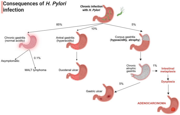 Why internists should care about Helicobacter pylori: recapitulating ...