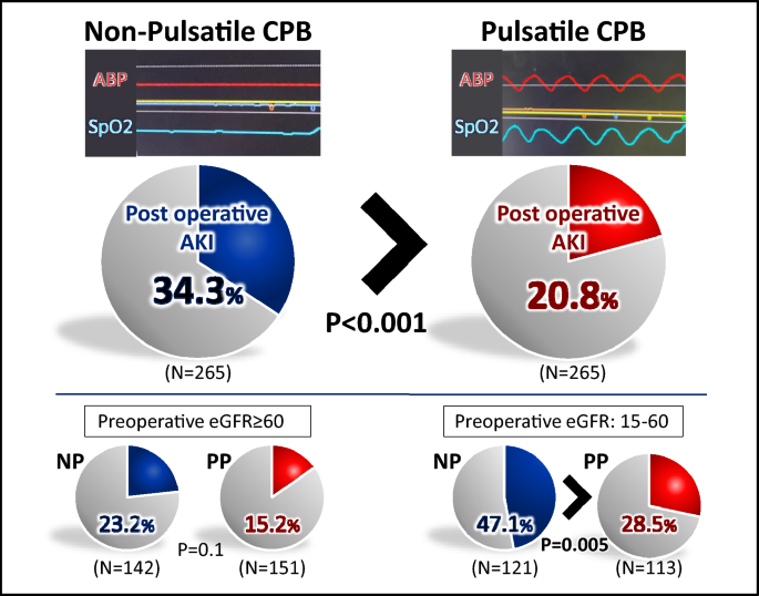 Pulsatile cardiopulmonary bypass using a centrifugal pump reduces acute ...