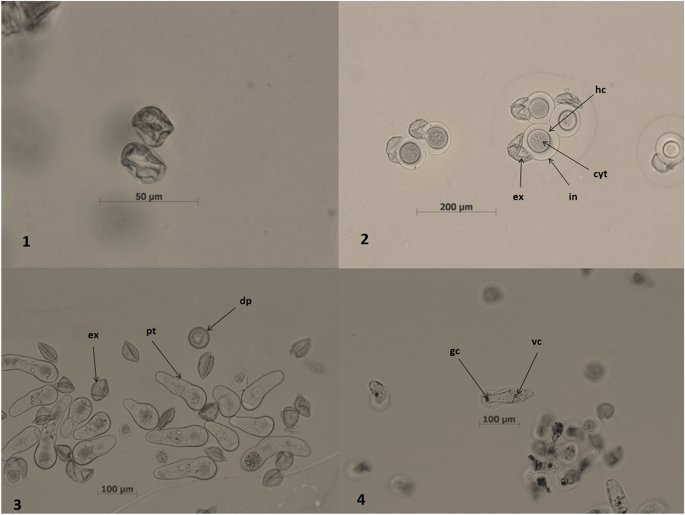 Pollen viability in three Juniperus taxa | Biologia