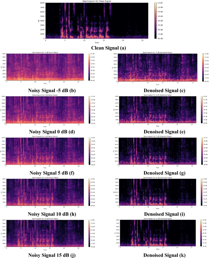 Speech enhancement using deep complex convolutional neural network (DCCNN) model | Signal, Image ...