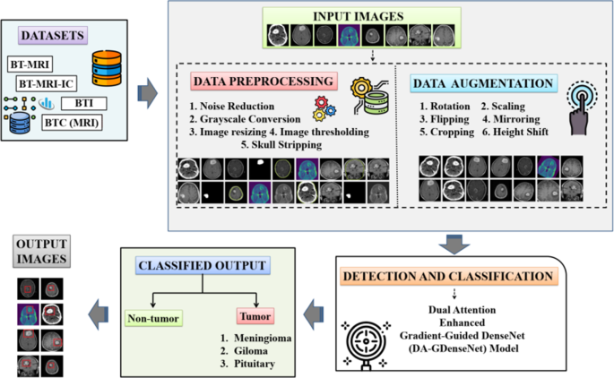 MRI-based brain tumor detection using dual attention mechanisms and ...