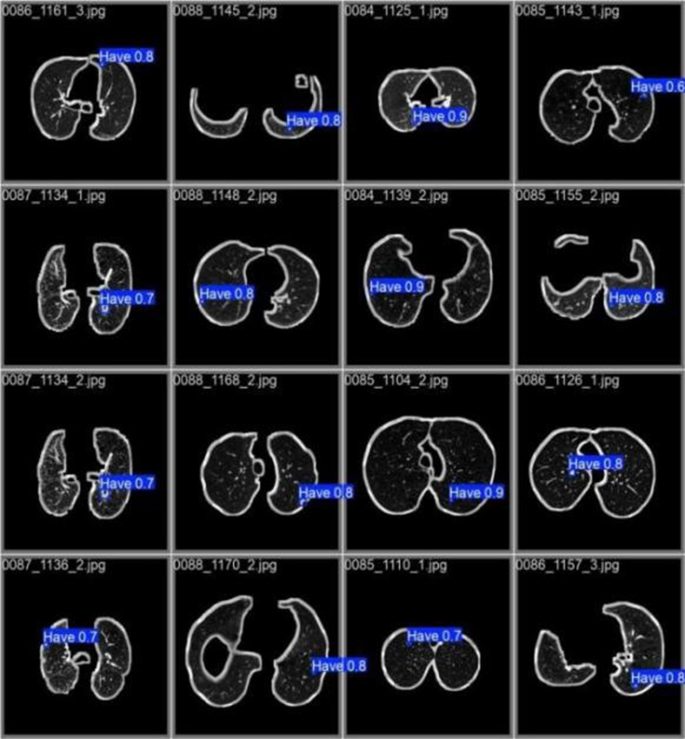 YOLOv8-EMFA: an enhanced multi-feature aggregation network for ...