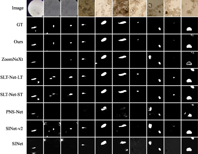 Memory Aggregation Network for Video Camouflaged Object Detection of Activated Sludge ...
