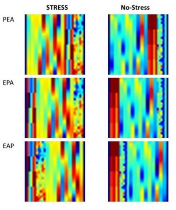 Multimodal signal fusion for stress detection using deep neural ...