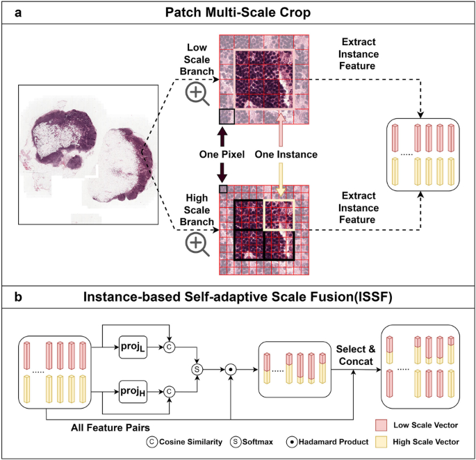 Enhancing whole slide image classification via fine-grained adaptive ...