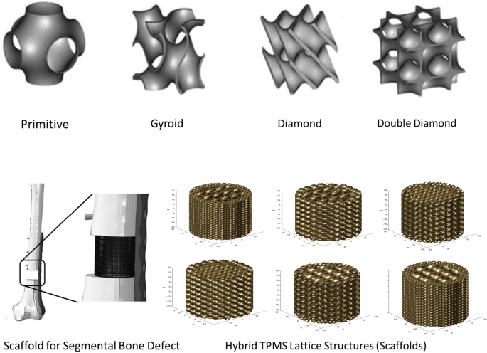 An Overview of Design and Development of Biomimetic Bone Scaffolds Using Heterogeneous TPMS ...