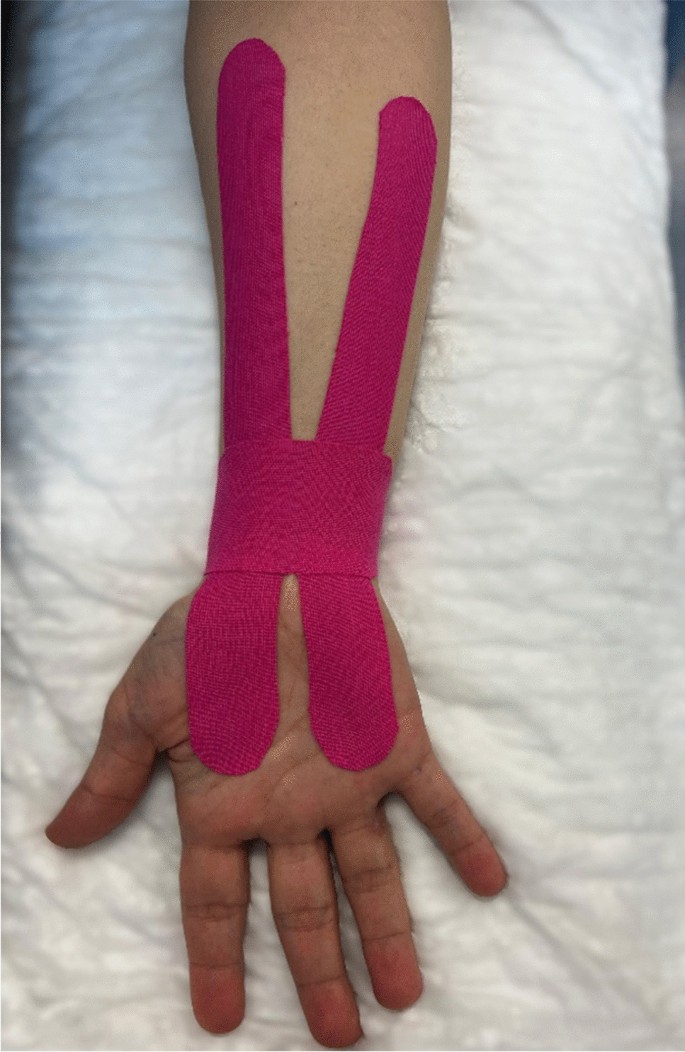 Effects of radial extracorporeal shock wave and kinesio taping on pain ...