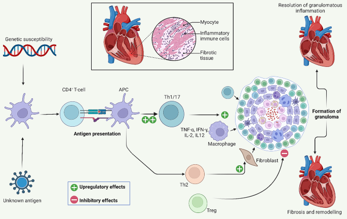 A Comprehensive Review on the Electrocardiographic Manifestations of ...