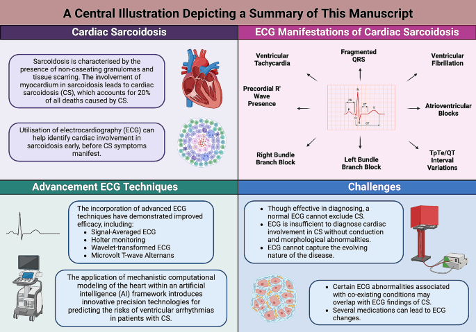 A Comprehensive Review on the Electrocardiographic Manifestations of ...